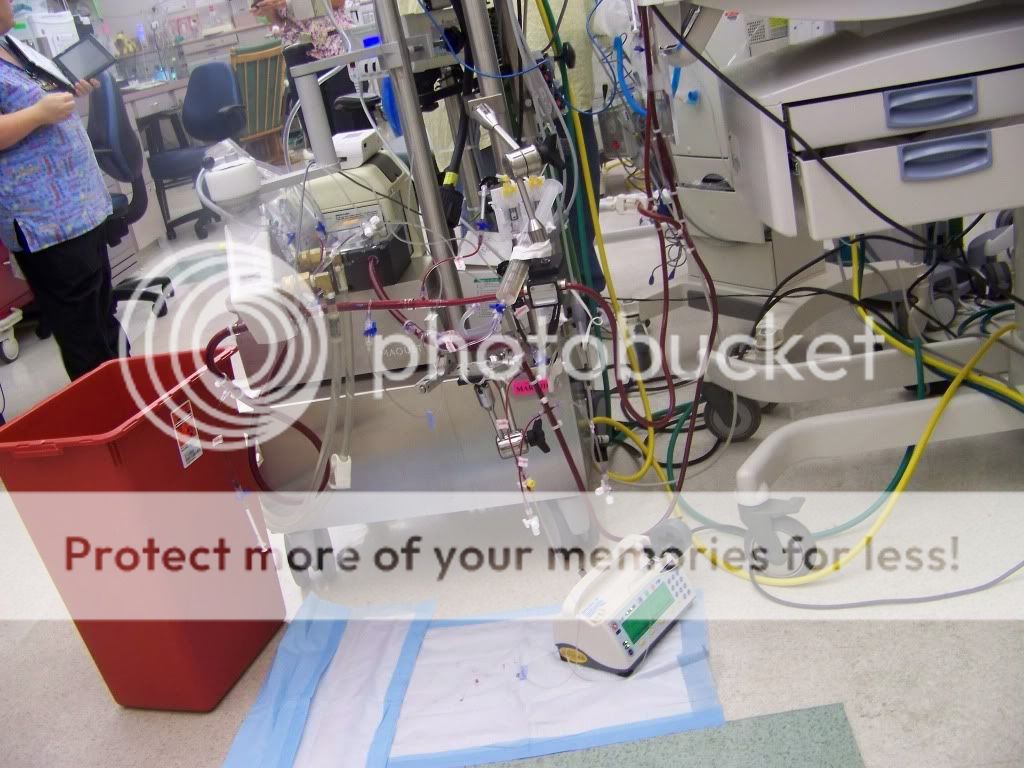 Ecmo Machine Animated Gifs | Photobucket